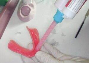 Denture Soft Liners: The Comfort Solution for Denture Wearers - Seattle ...